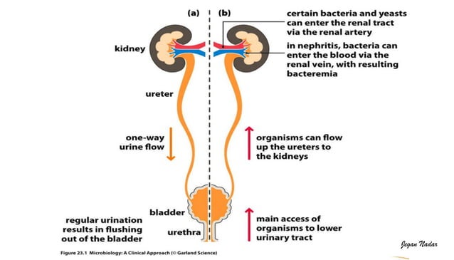 Pathophysiology of Urinary tract infection