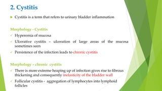 Urinary Tract Infection.pptx