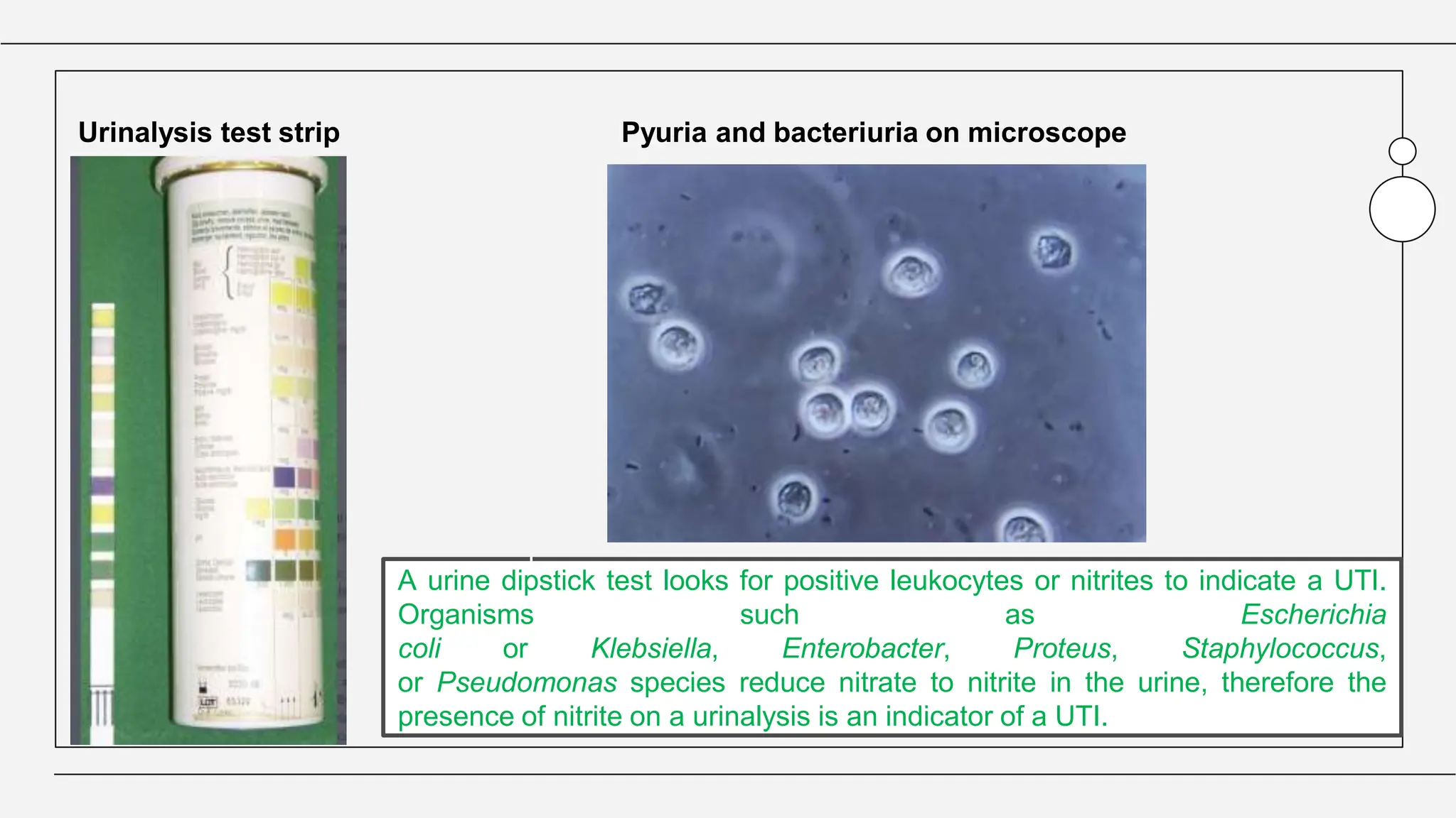 Urinary Tract Infection.pptx , cystitis , lower and upper urinary tract ...