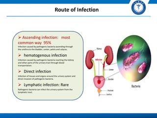 Urinary track infection disease of urina | PPTX