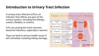 Urinary Tract Infection copy.pptx………………… | PPT