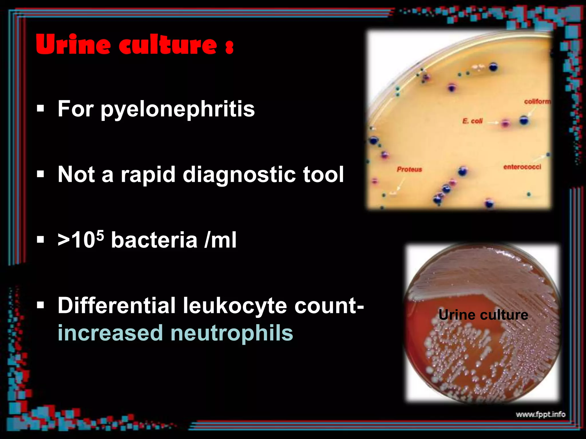 Urinary tract infections | PPTX
