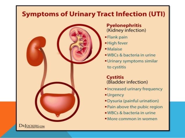 Urinary tract infections