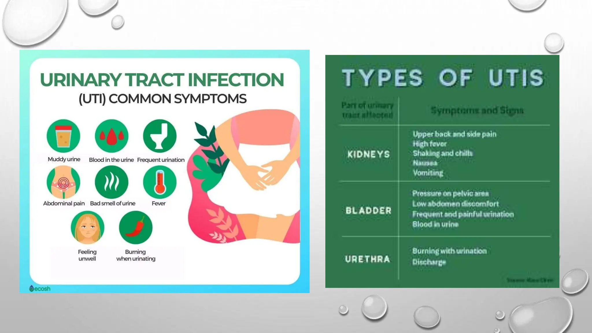 URINARY TRACT INFECTIONS.pptx