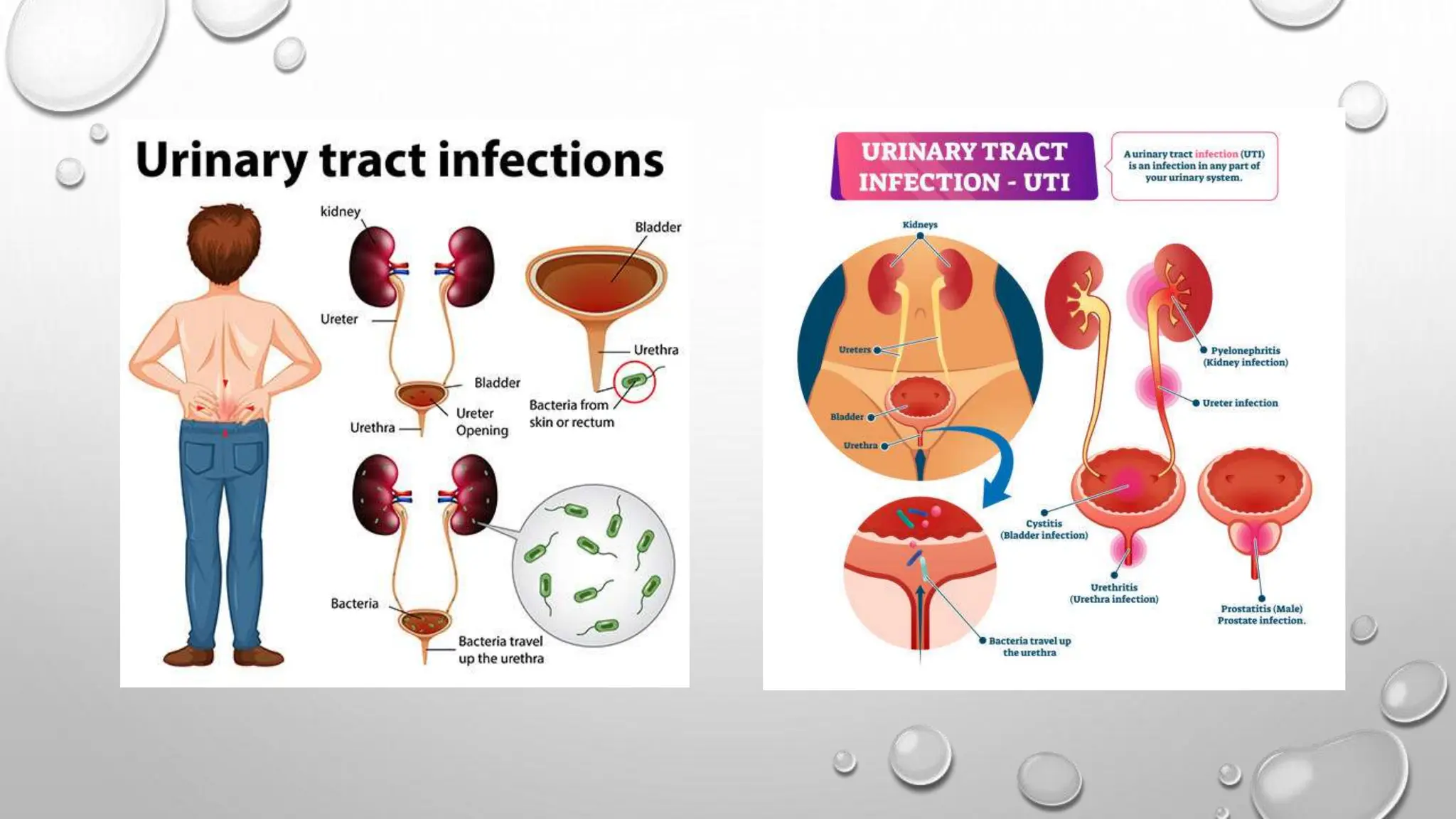 URINARY TRACT INFECTIONS.pptx