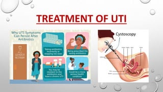 URINARY TRACT INFECTIONS.pptx