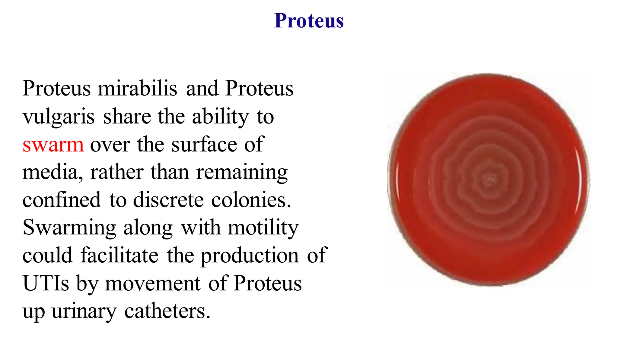 Urinary tract infections in adults male.pdf