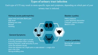 Urinary tract infections on children ERVIS CARA | PPT