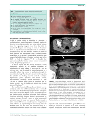 Urinary tract injuries | PDF