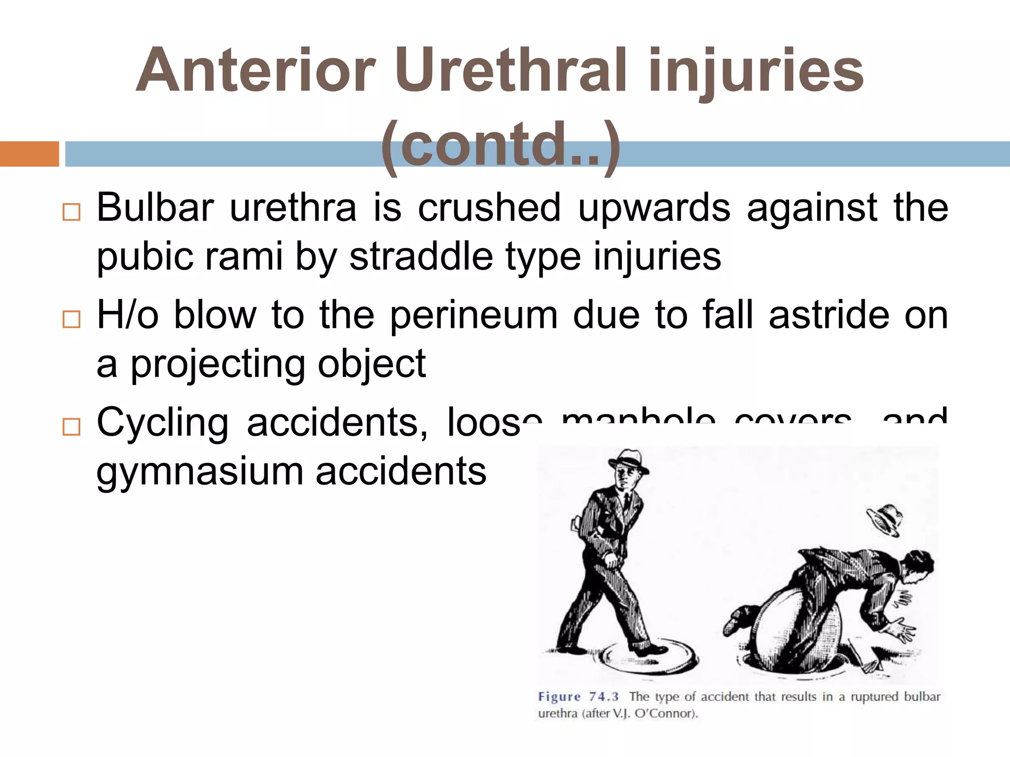 Urinary tract injury (kidney injury) | PPTX