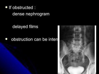 radiology.Urinary tract lecture 2.(dr.nasr) | PPT | Digestive Disorders ...