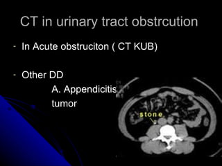 radiology.Urinary tract lecture 2.(dr.nasr) | PPT | Digestive Disorders ...