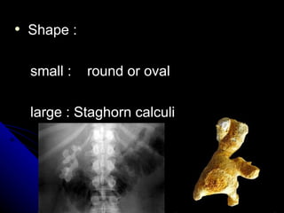 radiology.Urinary tract lecture 2.(dr.nasr) | PPT