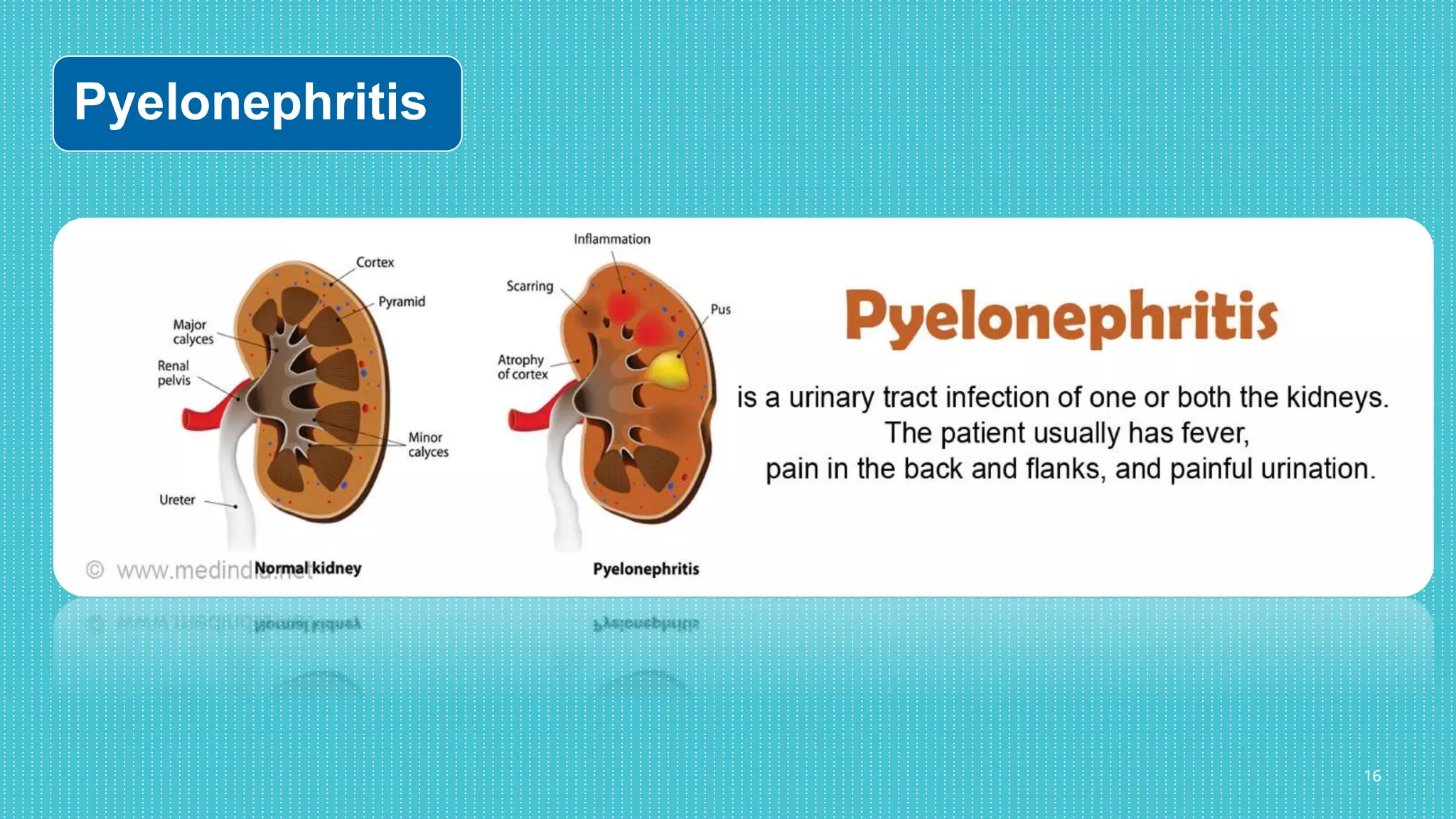 urinary tract MICROBIOME.pptx