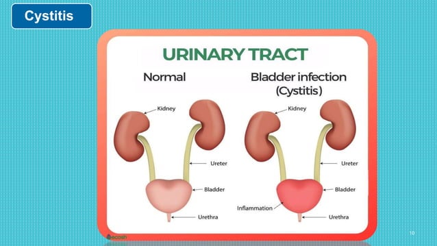 urinary tract MICROBIOME.pptx