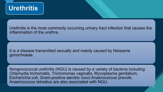 urinary tract MICROBIOME.pptx