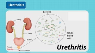 urinary tract MICROBIOME.pptx
