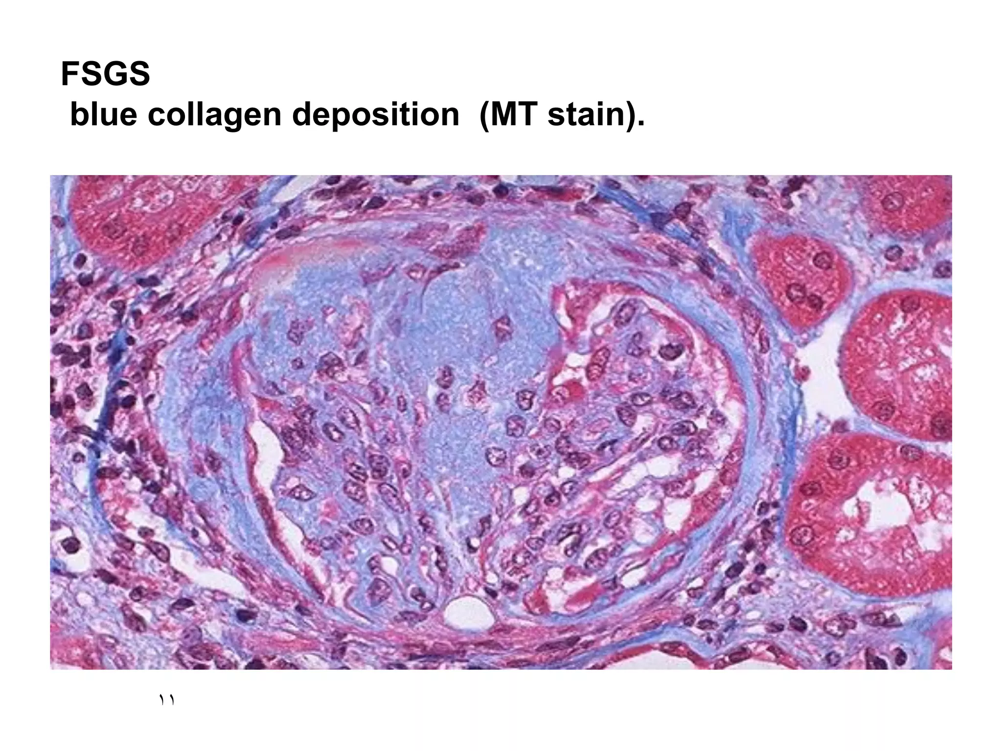 Urinary tract pathology lab | PDF