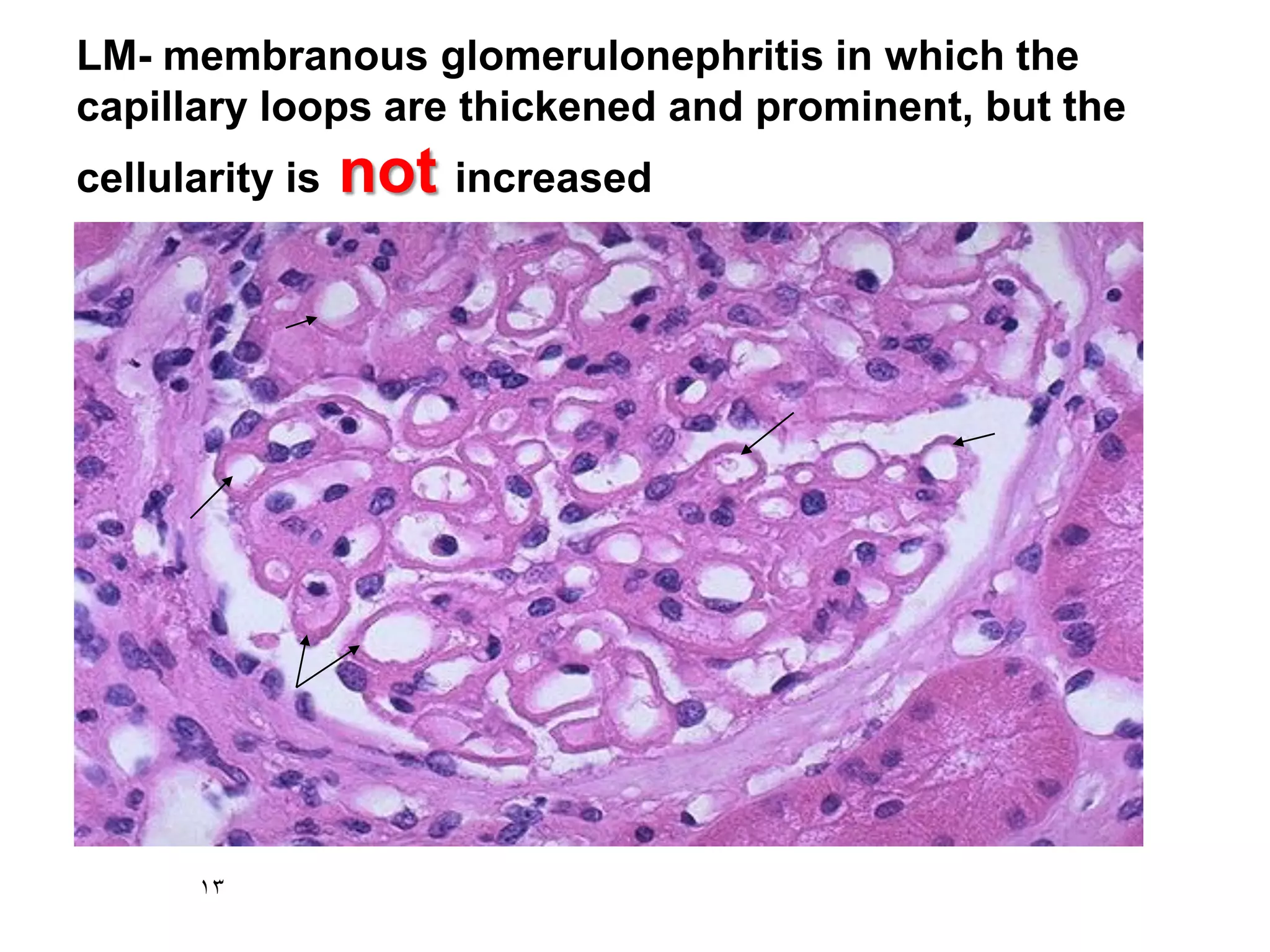 Urinary tract pathology lab | PDF