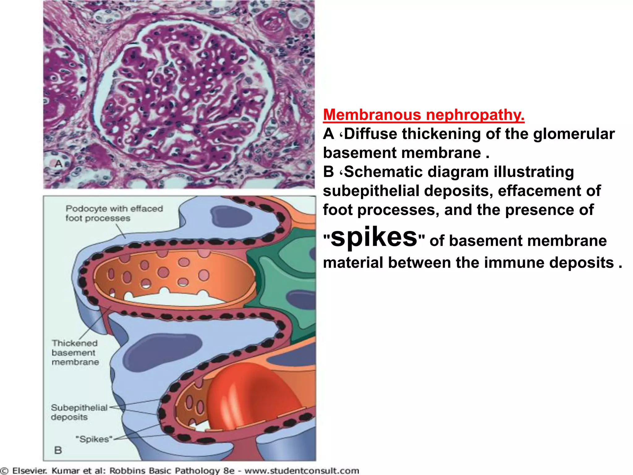 Urinary tract pathology lab | PDF