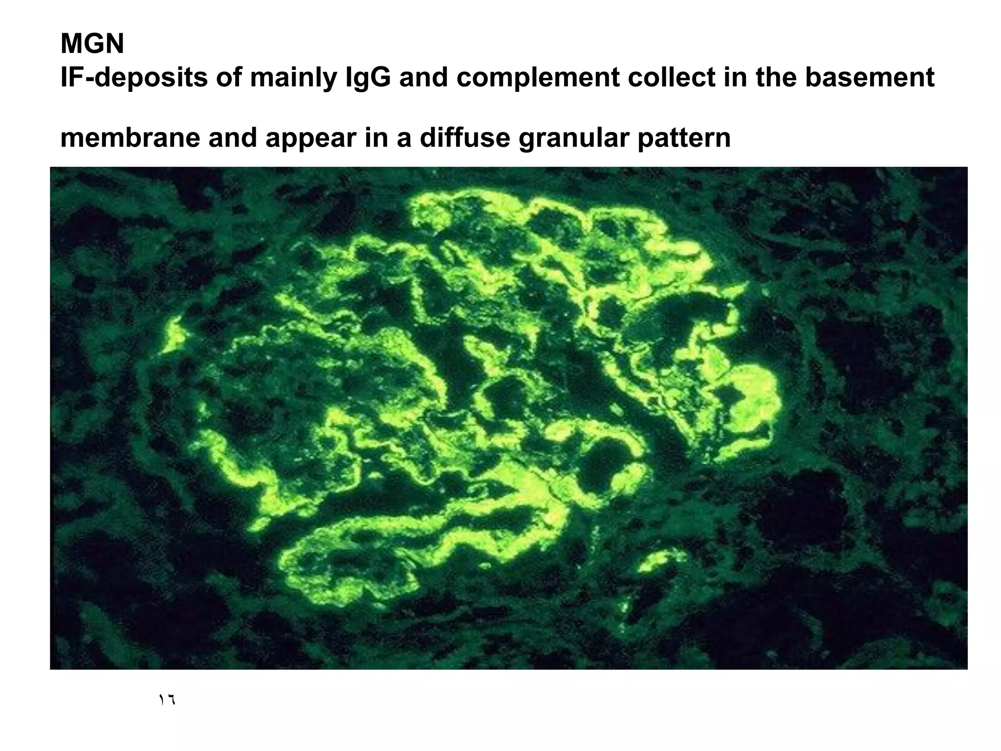Urinary tract pathology lab | PDF