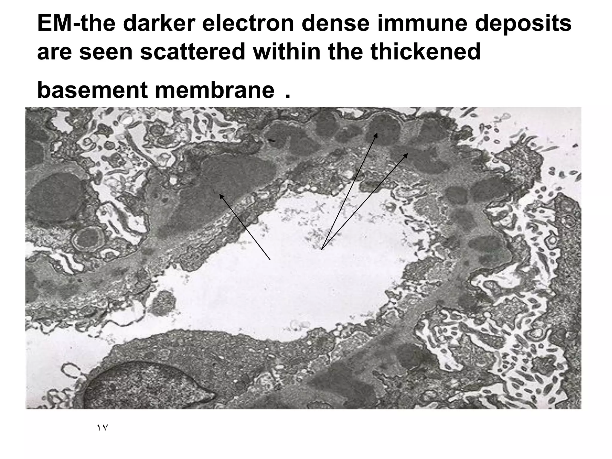 Urinary tract pathology lab | PDF