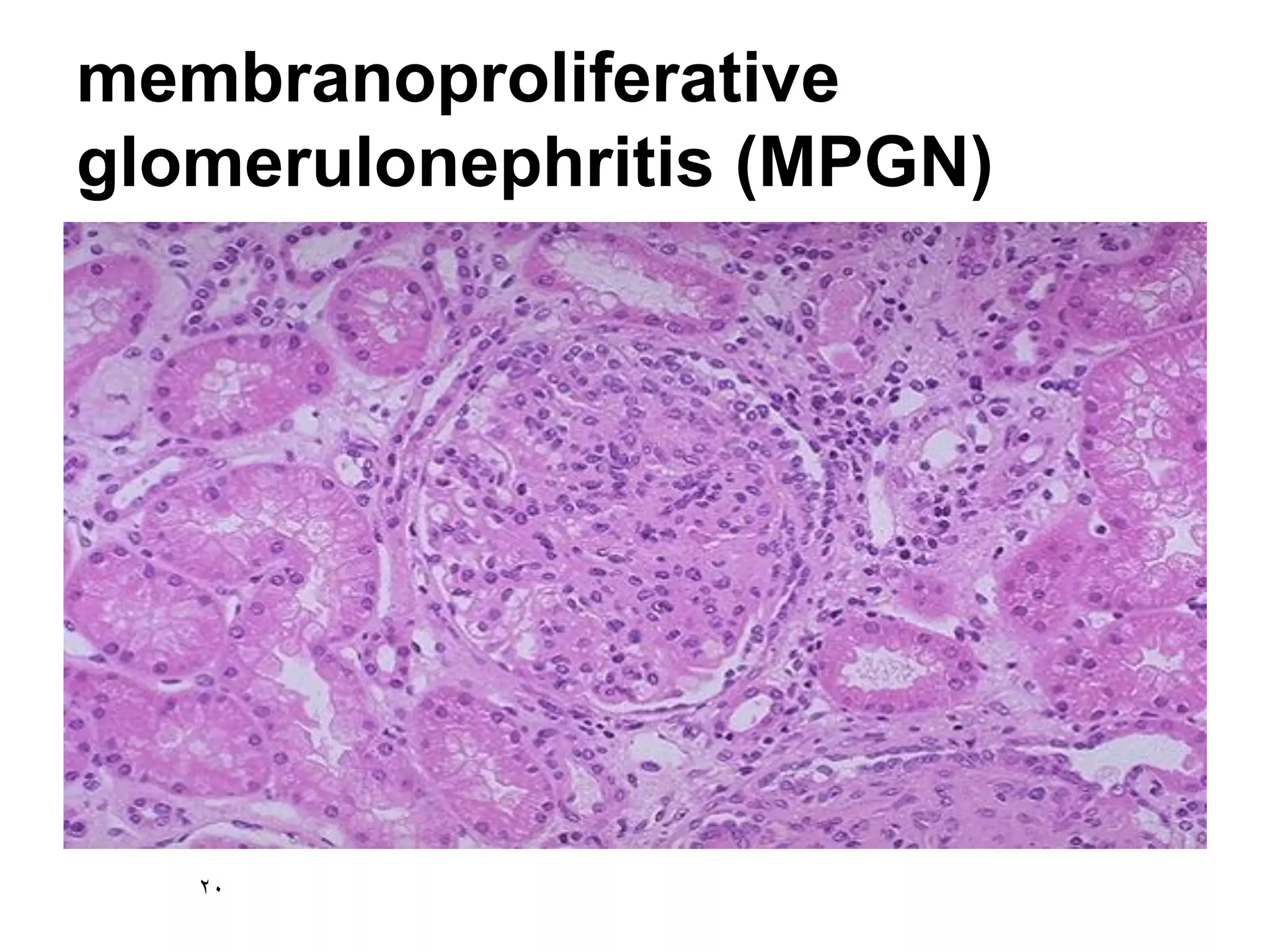 Urinary tract pathology lab | PDF
