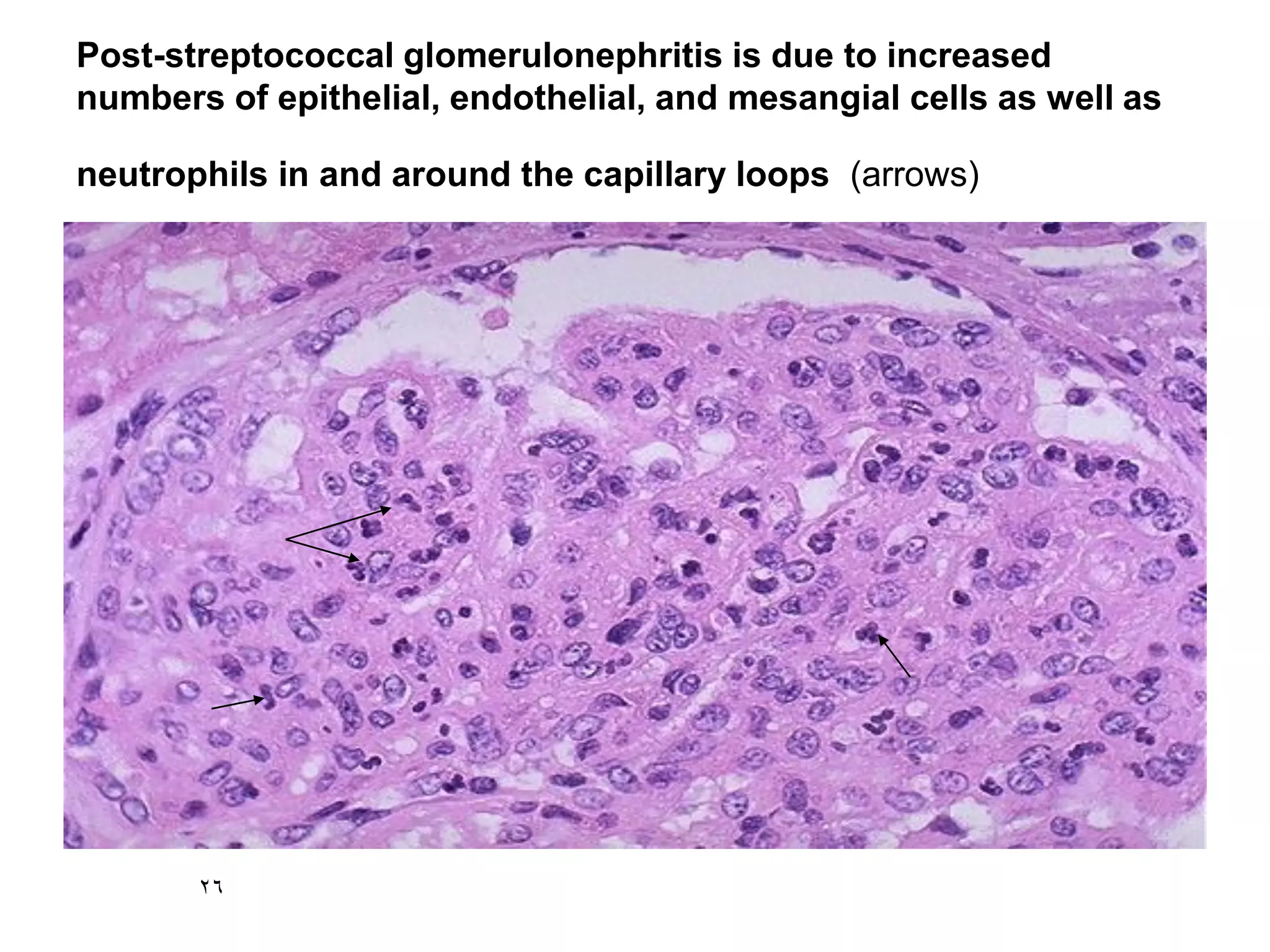 Urinary tract pathology lab | PDF