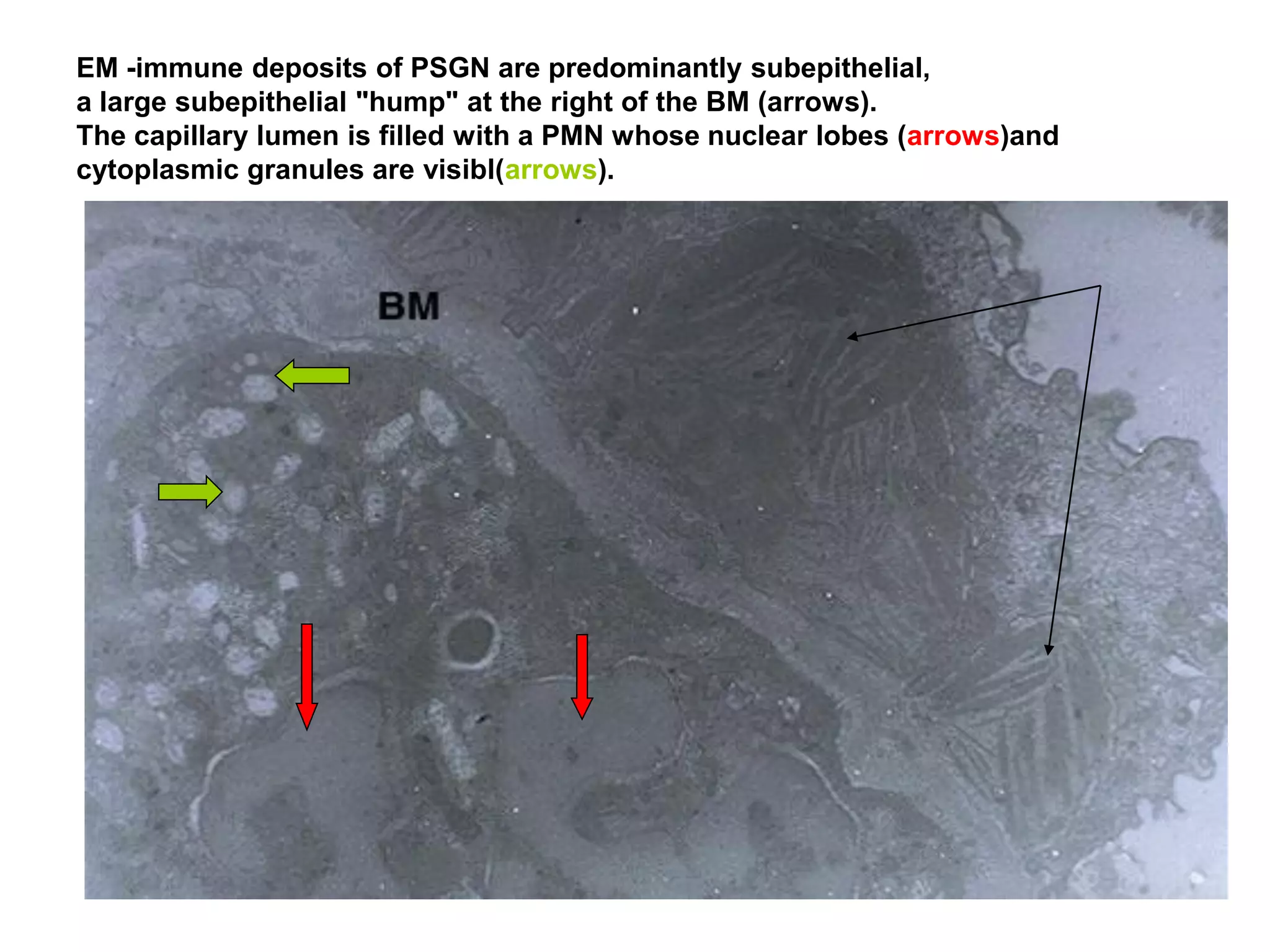 Urinary tract pathology lab | PDF