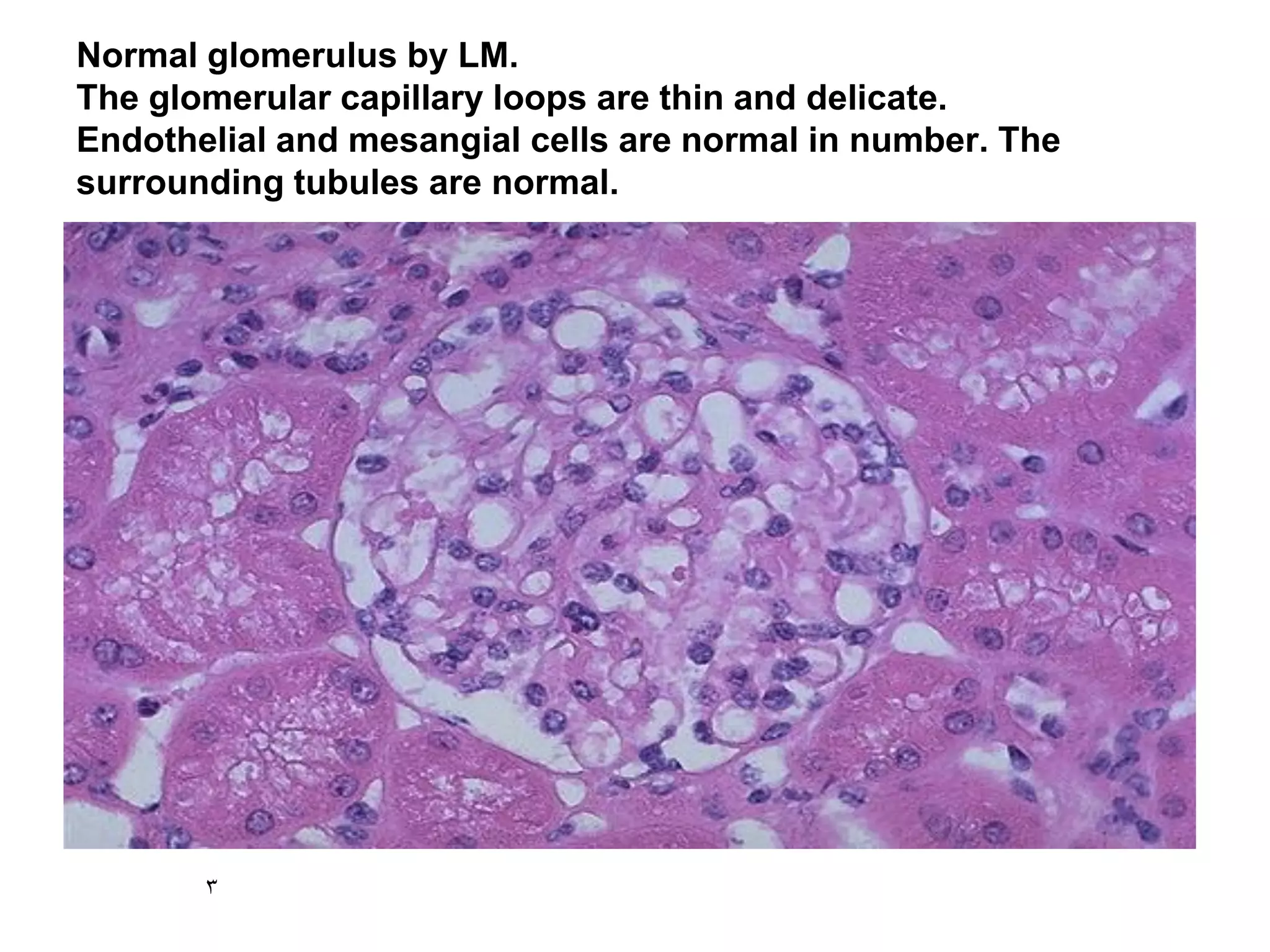 Urinary tract pathology lab | PDF