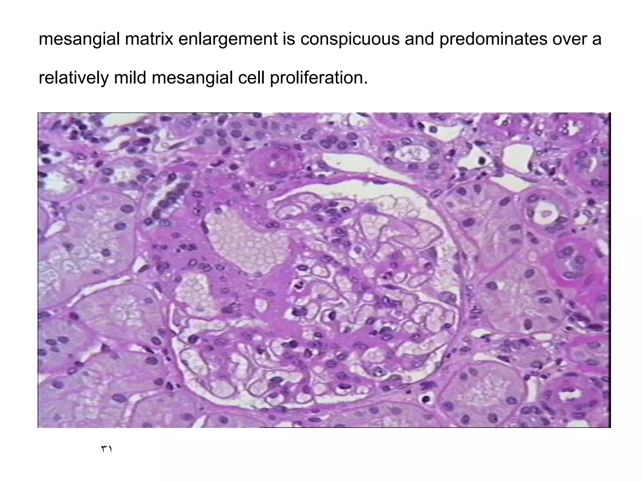 Urinary tract pathology lab | PDF