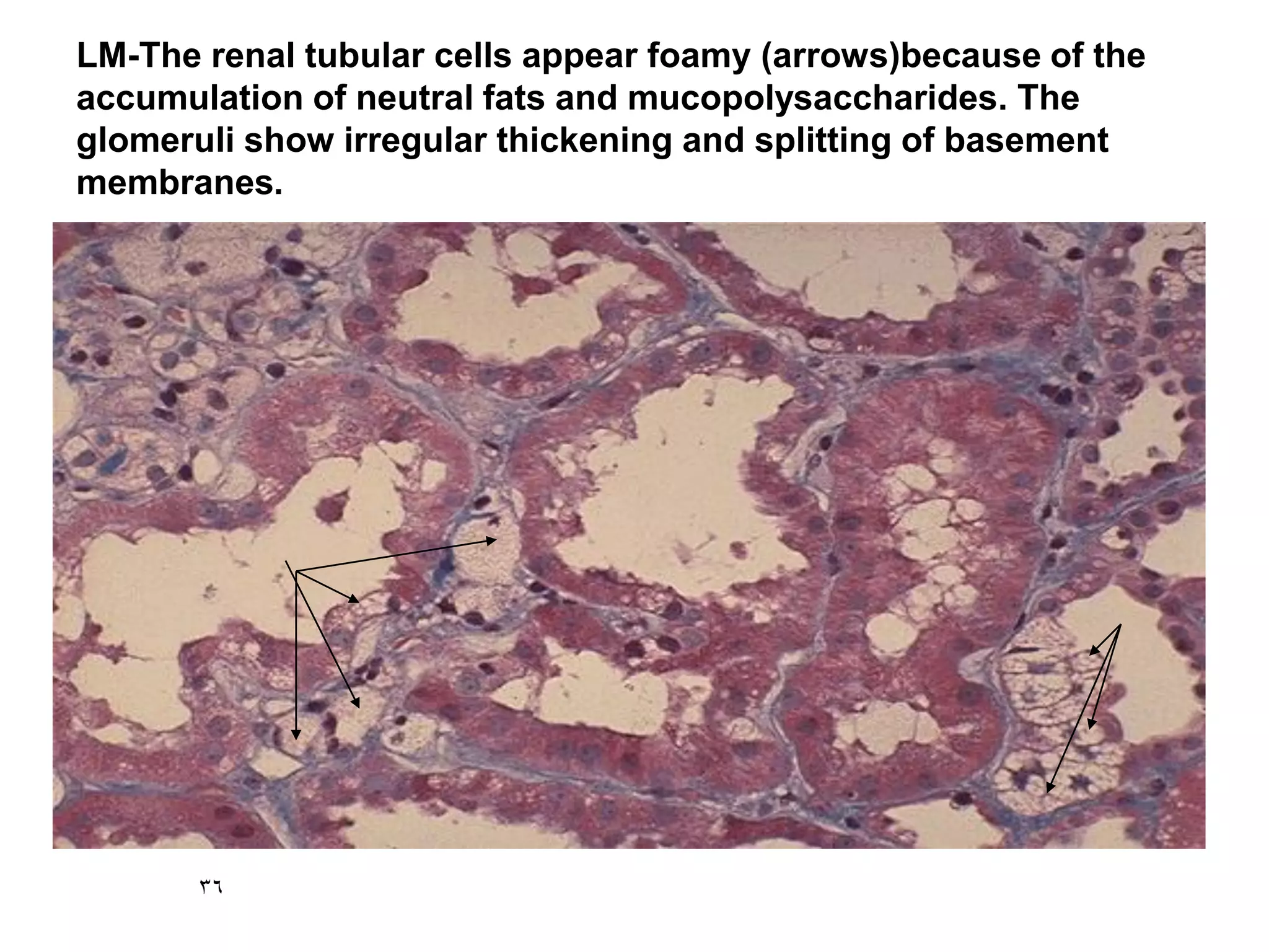 Urinary tract pathology lab | PDF