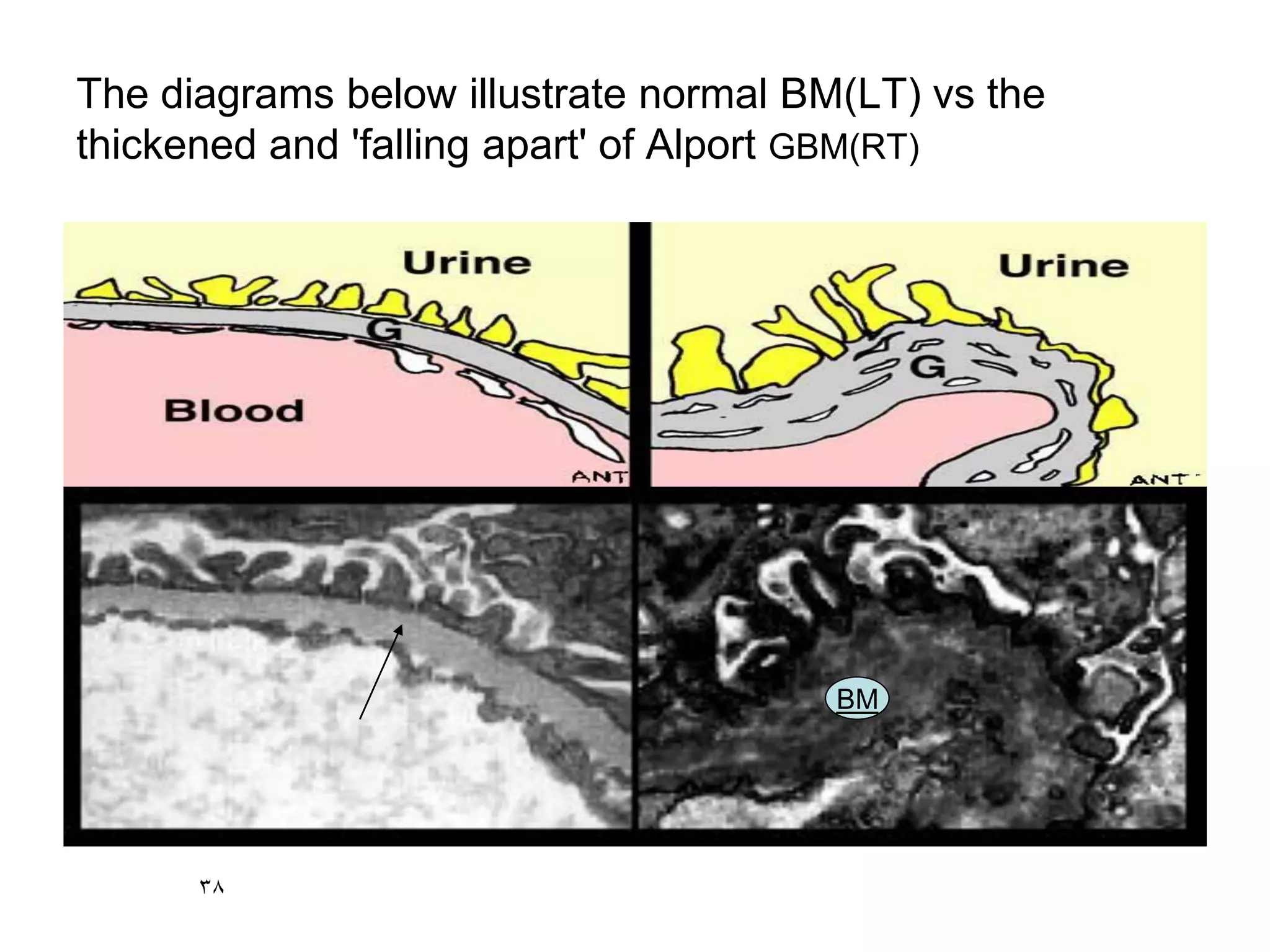 Urinary tract pathology lab | PDF