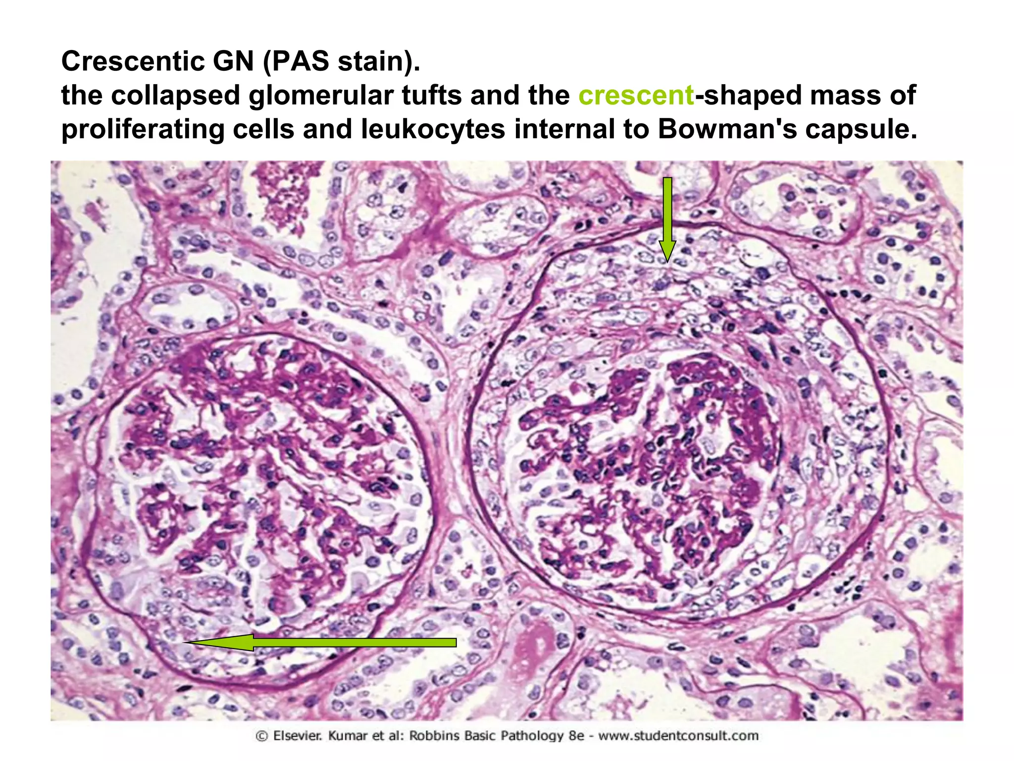 Urinary tract pathology lab | PDF
