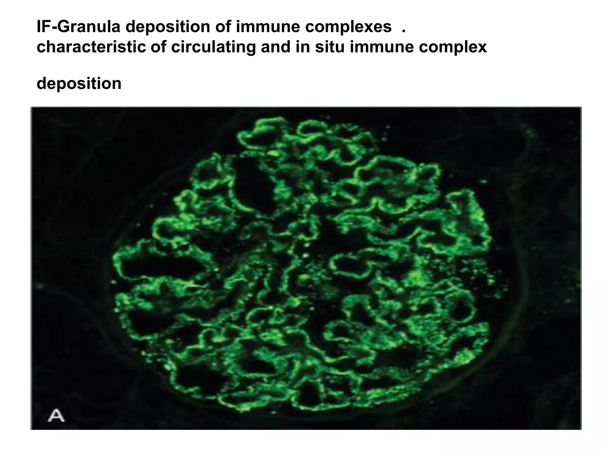 Urinary tract pathology lab | PDF