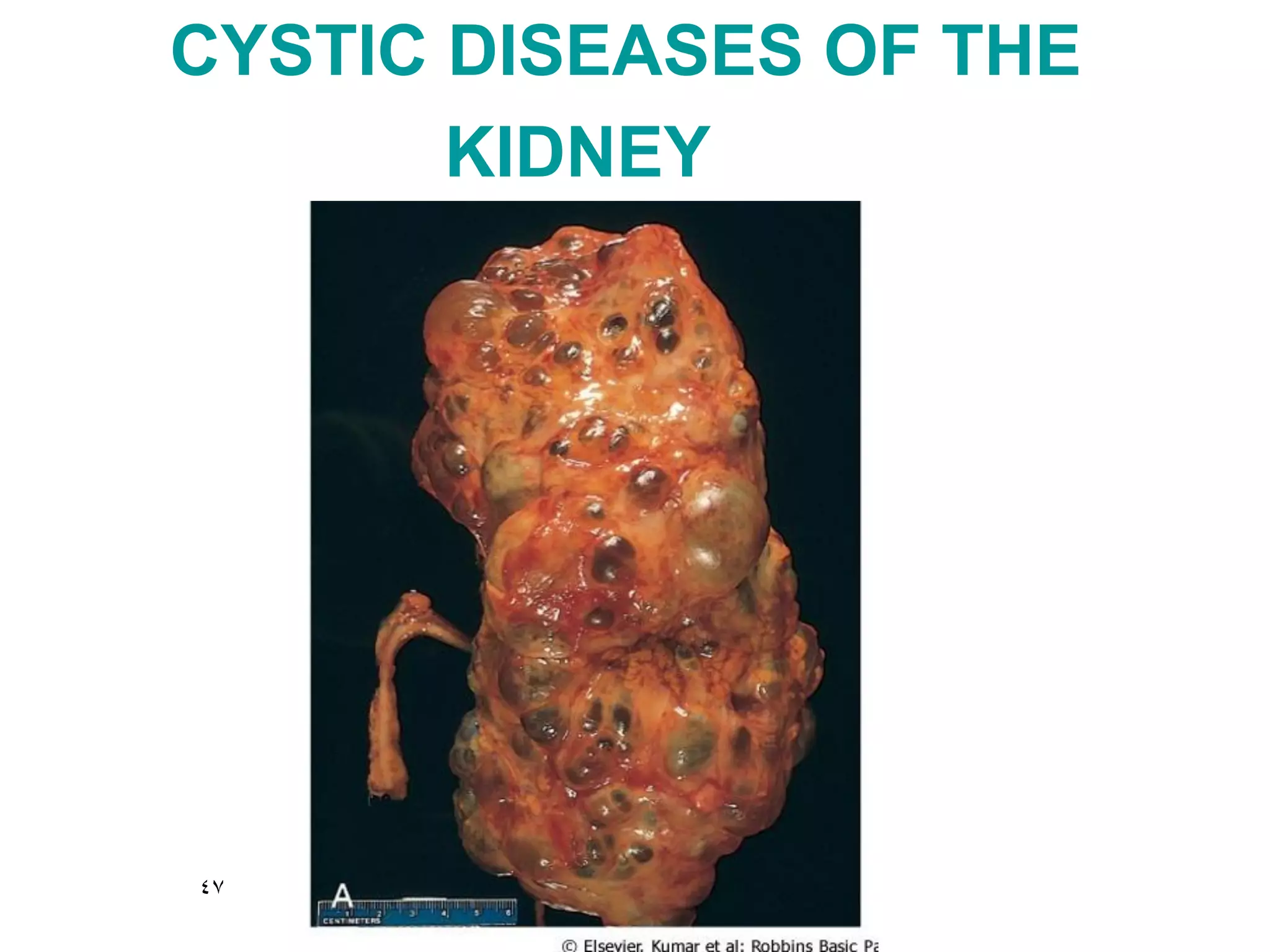 Urinary tract pathology lab | PDF