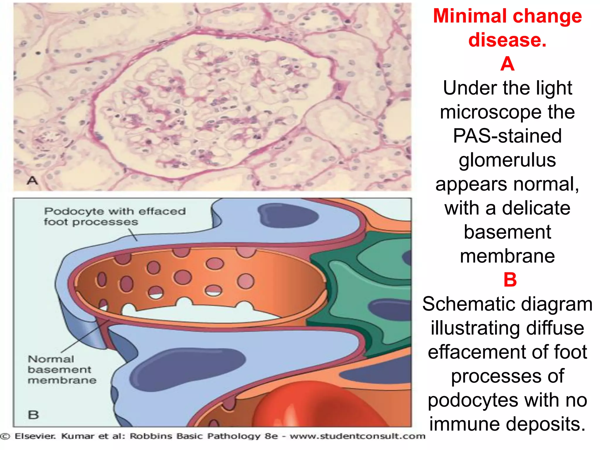 Urinary tract pathology lab | PDF