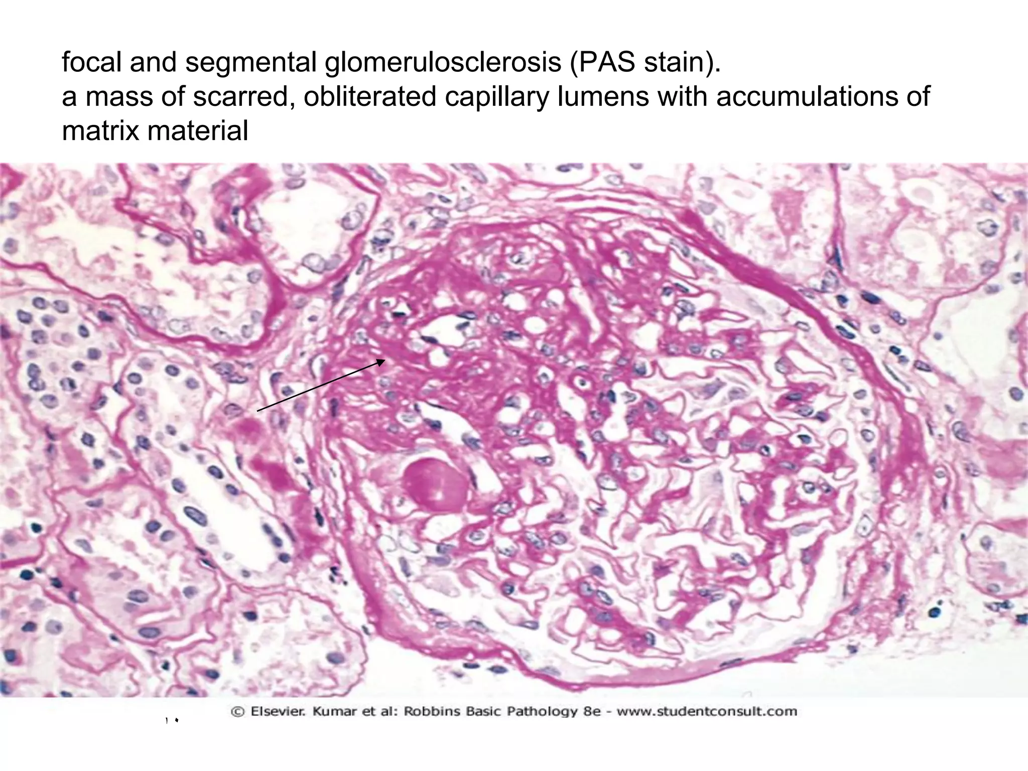 Urinary tract pathology lab | PDF