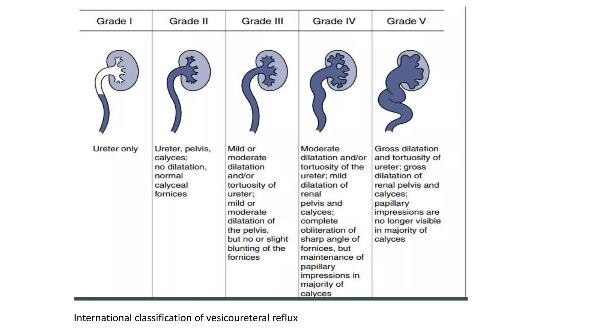 Urinary tracts infections in pediatrics (UTI) | PPTX