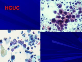 Urine.cytology | PPT