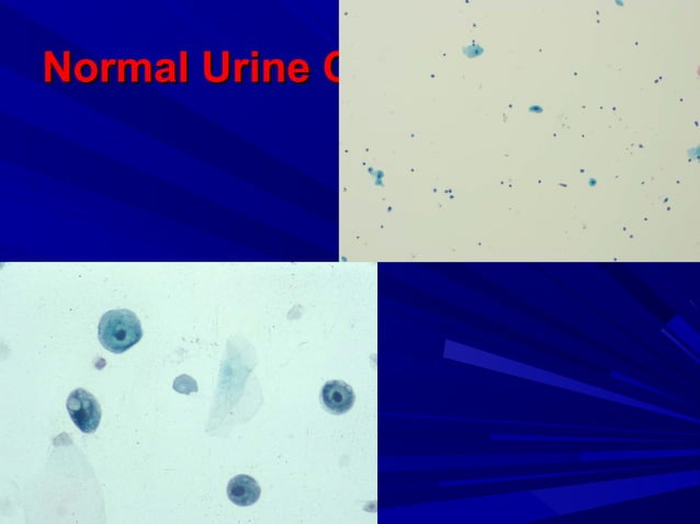 Urine.cytology | PPT