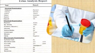 UrineUrine sample collection and examination .pptx