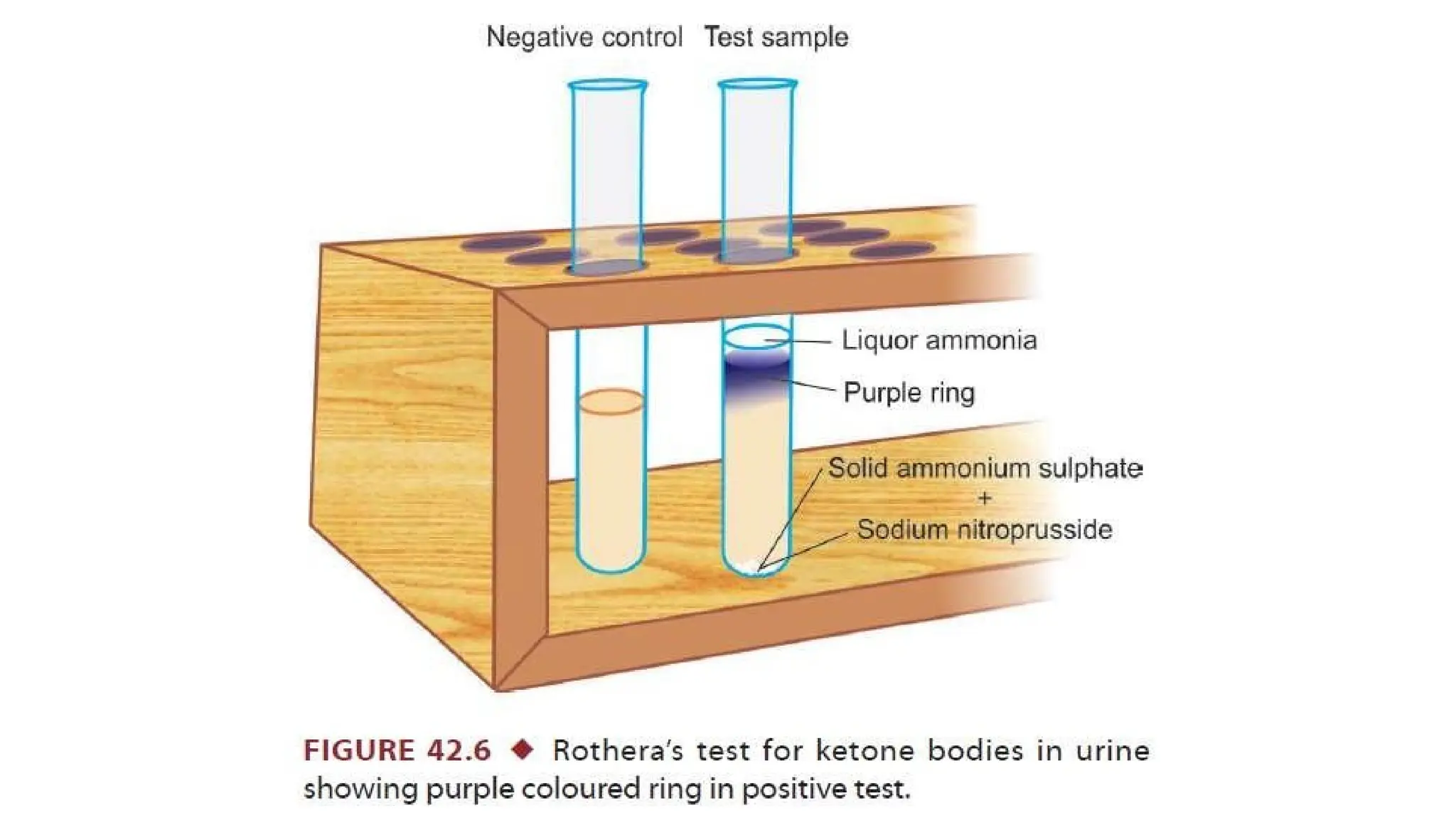 urine-analysis-ketone-body.pptx pathology | PPTX