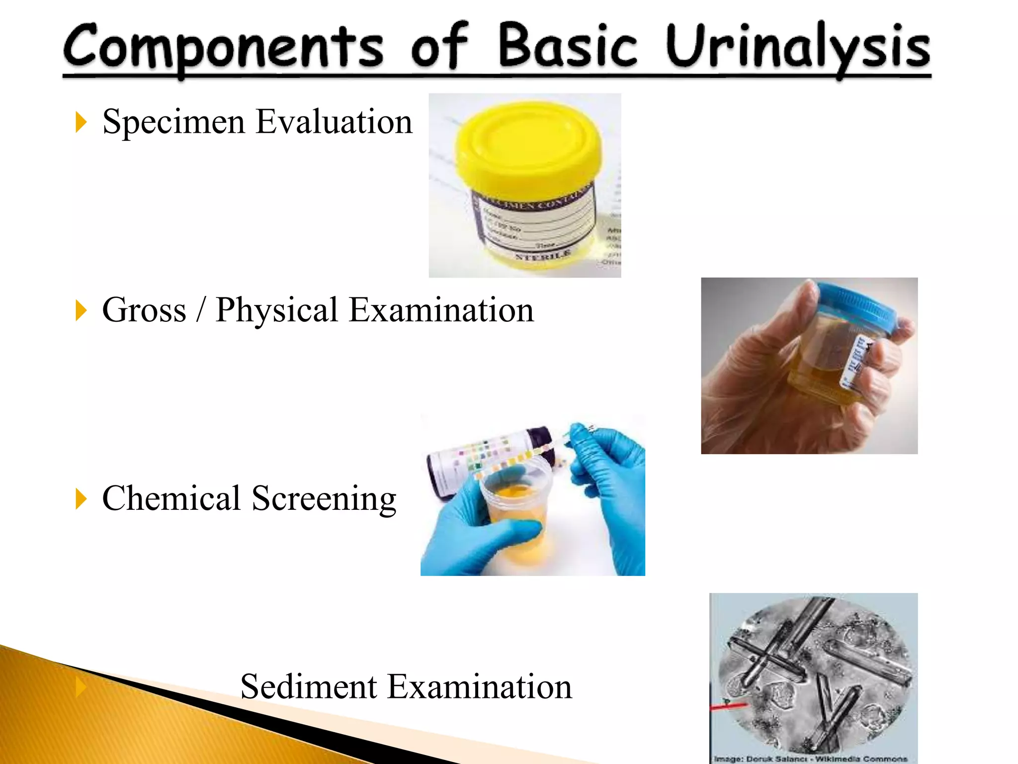 Urine -Physical and Chemical Examination and Reagent Strips | PPTX