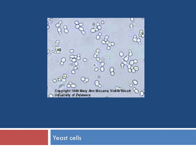 Urine-sediments- URINALYSIS STRASINGER.ppt