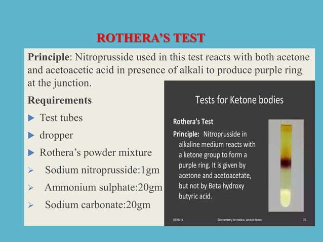 Urine acetone | PPTX | Endocrine and Metabolic Diseases | Diseases and ...