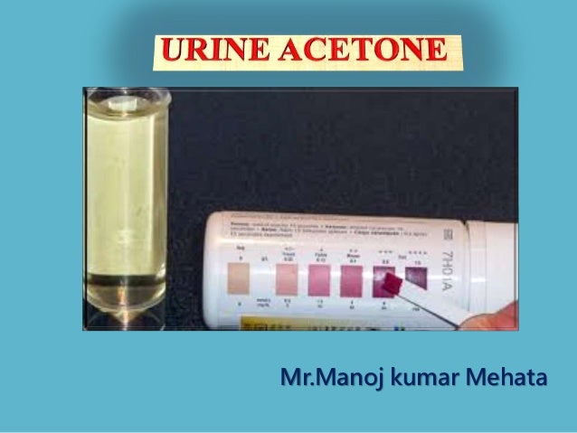 Urine acetone