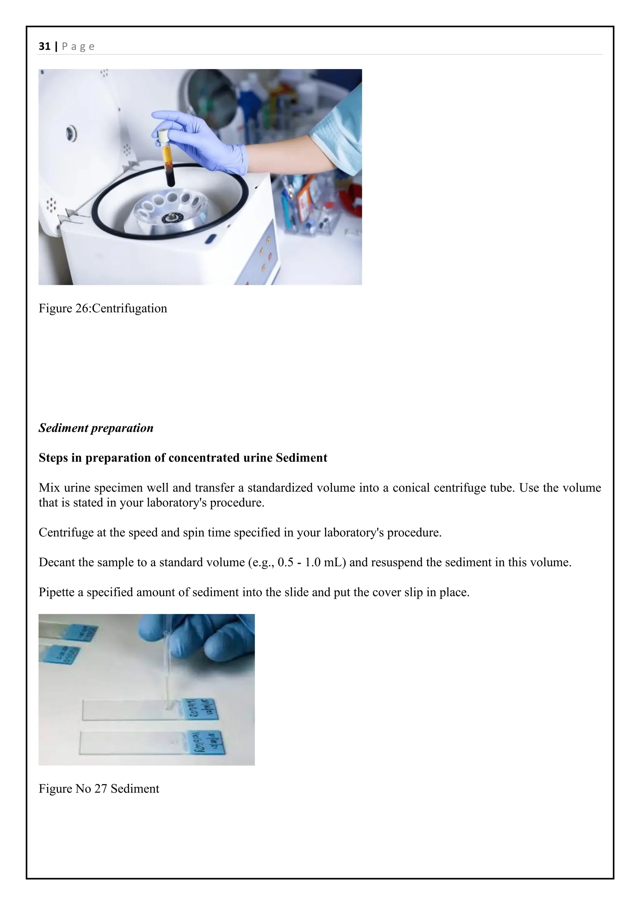 Urine Analysics Full Report -8371-M.Saihetharan.pdf