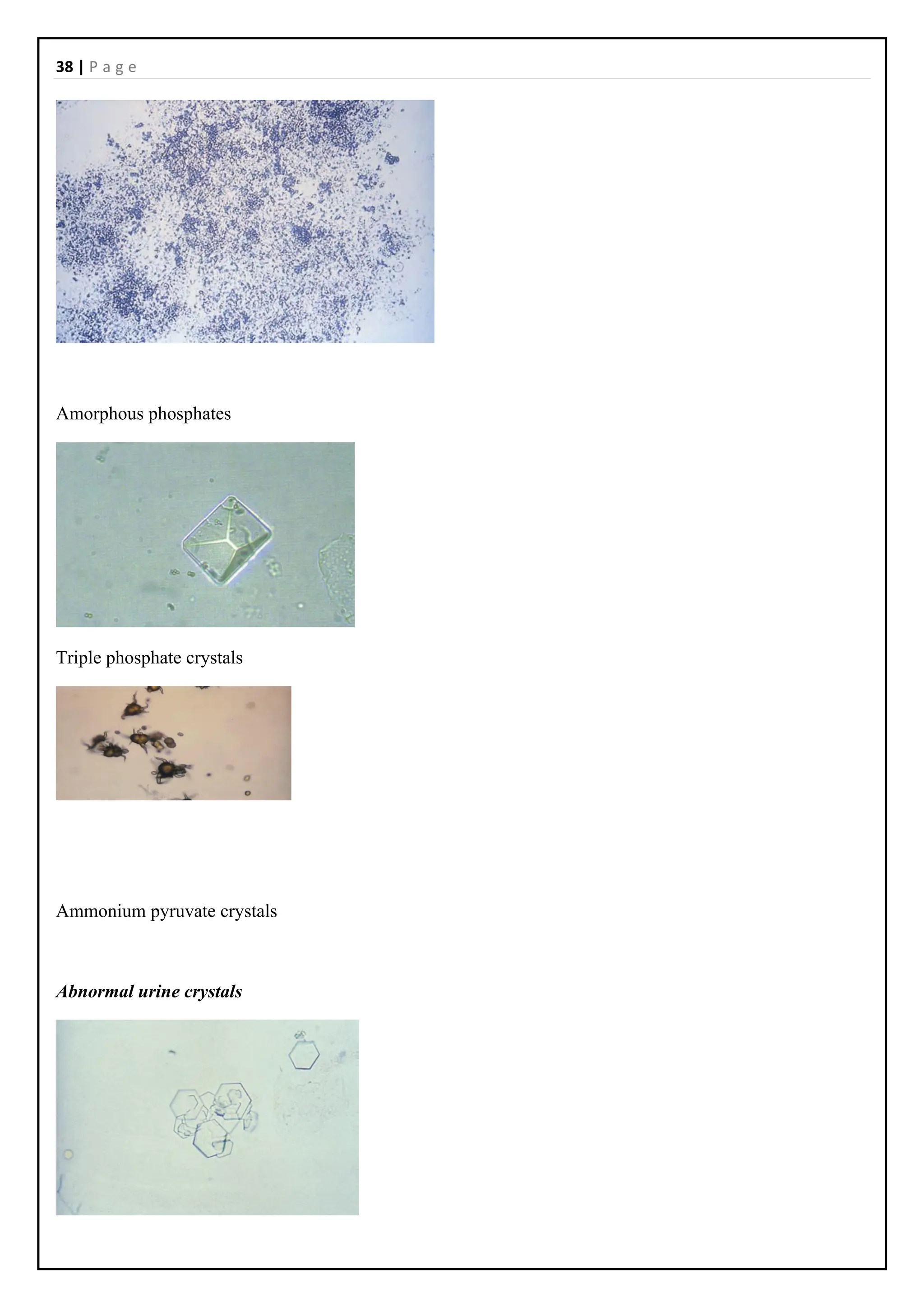 Urine Analysics Full Report -8371-M.Saihetharan.pdf