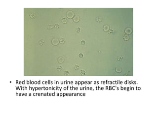 Urine analysis | PPTX